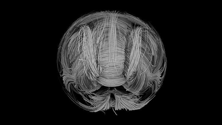 White Matter