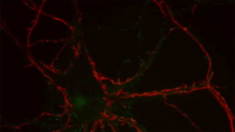 Making and Breaking Connections in the Brain